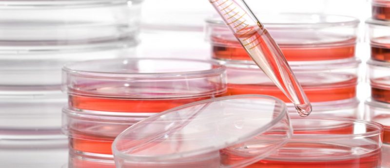 Bioengineered blood vessels show promise in dialysis patients - RegMedNet