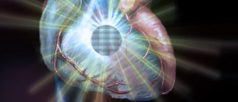 Injectable unfolding patch alleviates the need for open heart surgery ...