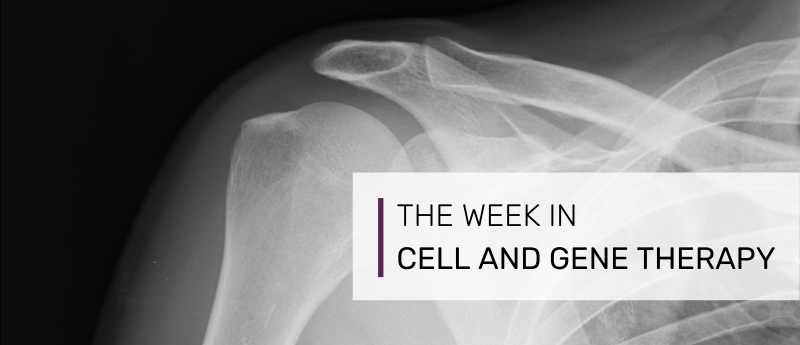 Cell therapy weekly: adult tendon regeneration achieved following ...