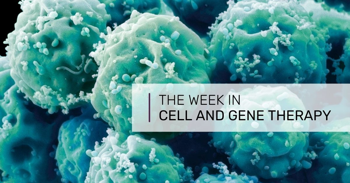 Cell therapy weekly: FDA approves Yescarta® CAR-T therapy for initial ...