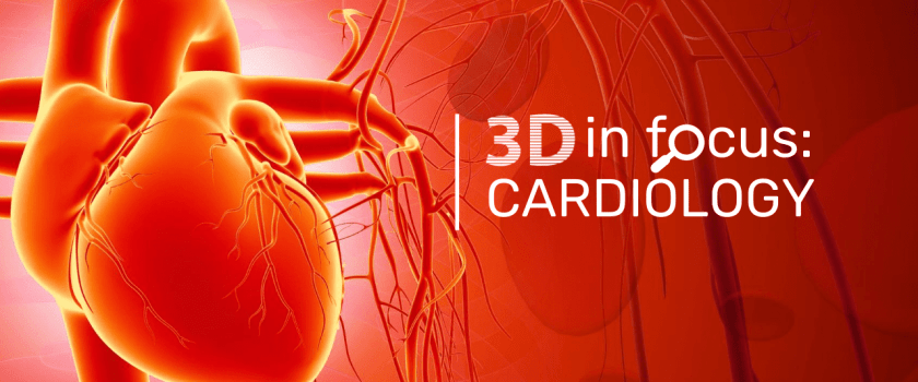 3D printing in cardiology: from bench to bedside - RegMedNet