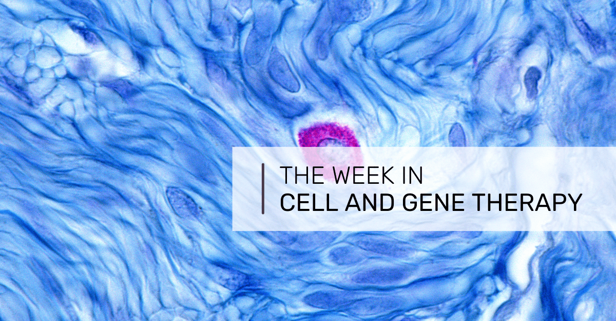 Cell therapy weekly: US$90M Series C funding for Forge Biologics