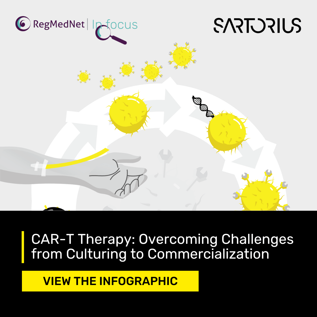 CAR-T Therapy: Overcoming Challenges from Culturing to ...