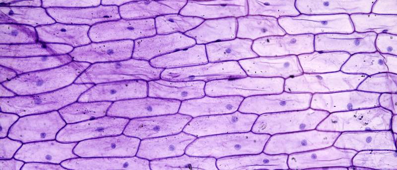 Autolog-ish: A Novel Way to Grow Skin Grafts - RegMedNet