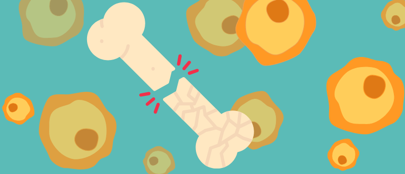 How Does Aging Impact the Process of Bone Regeneration? - RegMedNet