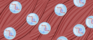 Gene Therapy Platform Shows Promise in Duchenne Preclinical Model ...