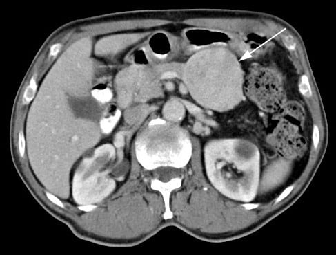 3D Systems announce the launch of Virtual Surgical Planning (VSP ...