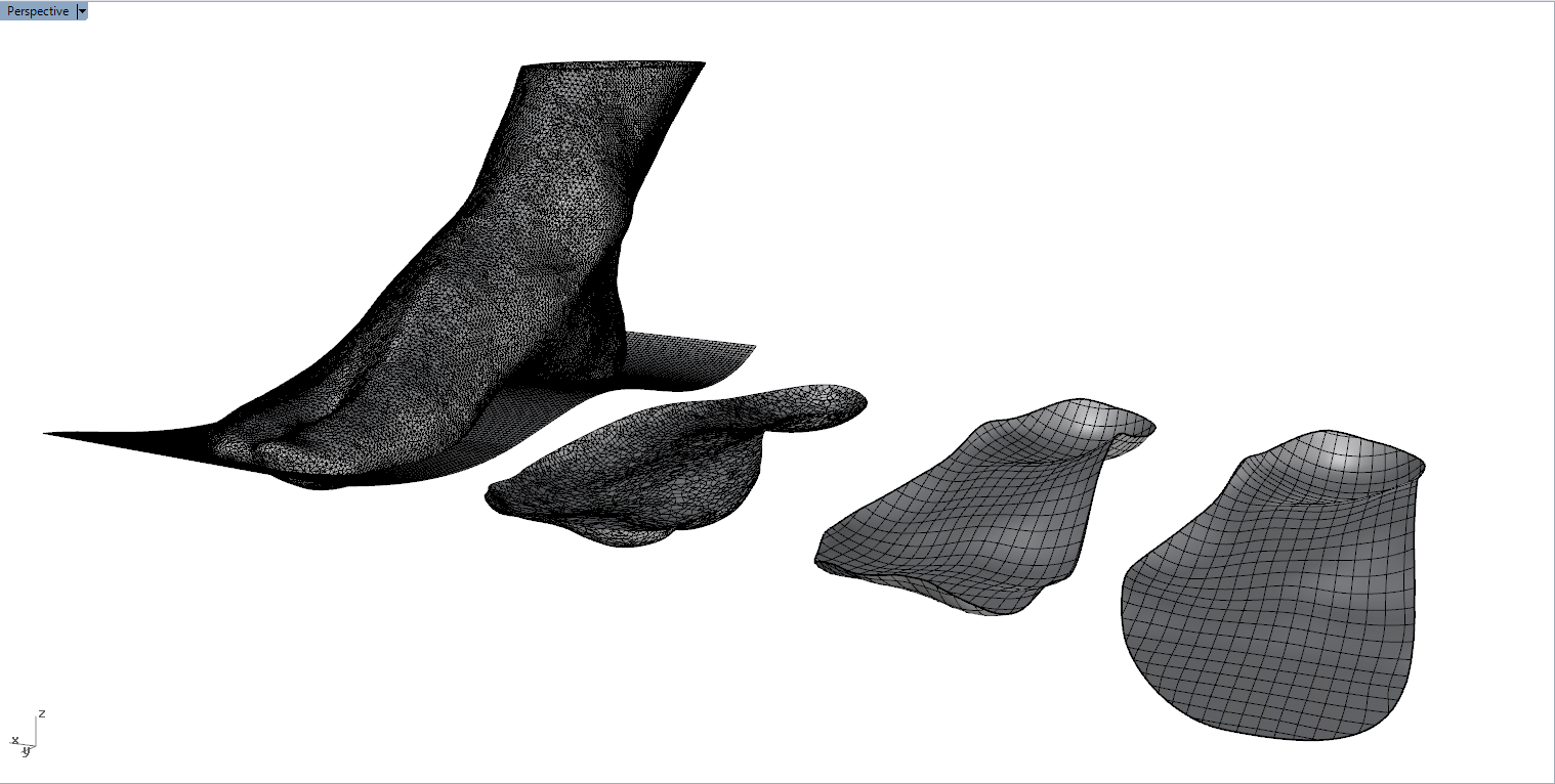 PHEET - an innovative solution for custom foot orthotics - RegMedNet